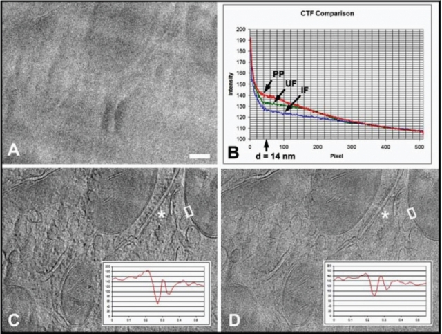 3D Electron Microscopy Group | New York State Department of Health ...