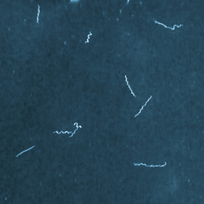Wadsworth Center Reports First Detection of Borrelia mayonii in New ...